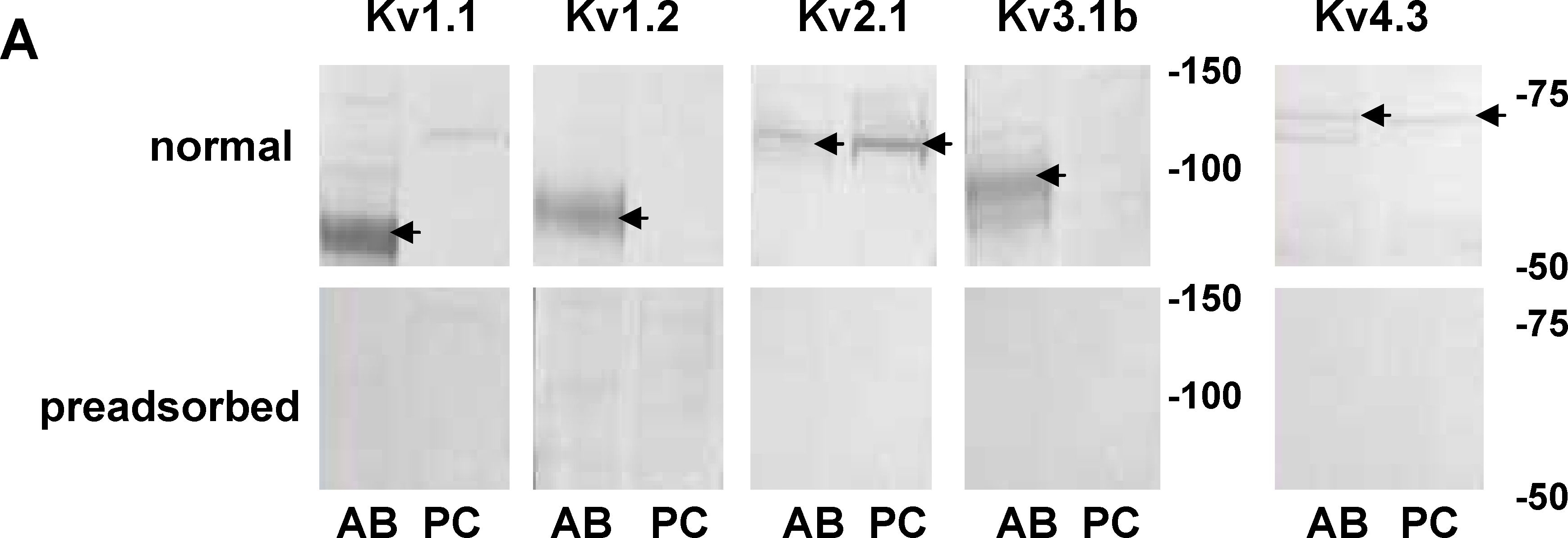 KV3.1 antibodies - Antibody search engine - CiteAb