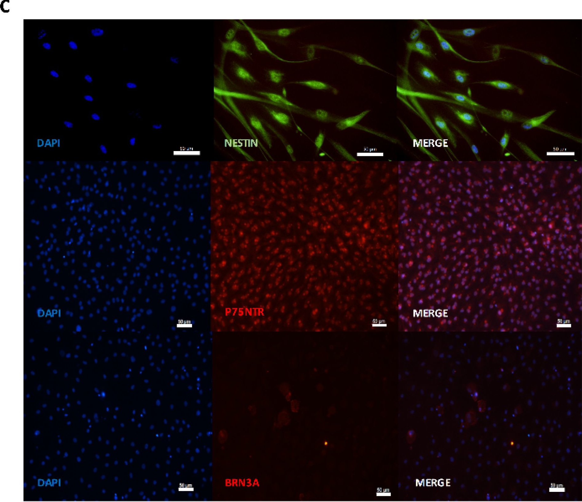 BRN3A antibodies - Antibody search engine - CiteAb