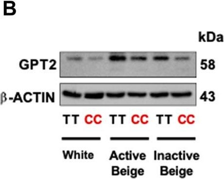 GPT2 antibodies - Antibody search engine - CiteAb