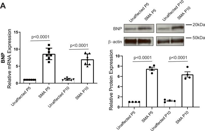 BNP antibodies - Antibody search engine - CiteAb