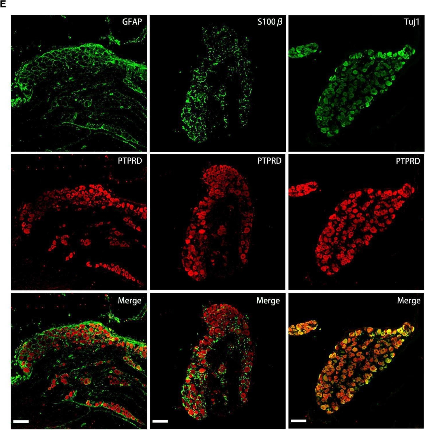 PTPRD antibodies - Antibody search engine - CiteAb
