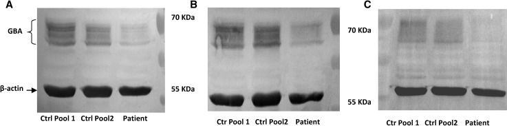GBA antibodies - Antibody search engine - CiteAb
