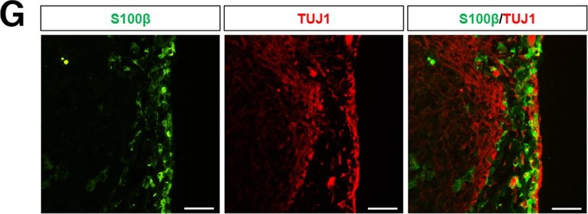 Tubb3 antibodies - Antibody search engine - CiteAb