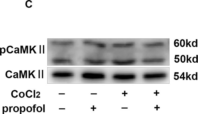 caMK antibodies - Antibody search engine - CiteAb