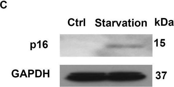 P16 antibodies - Antibody search engine - CiteAb