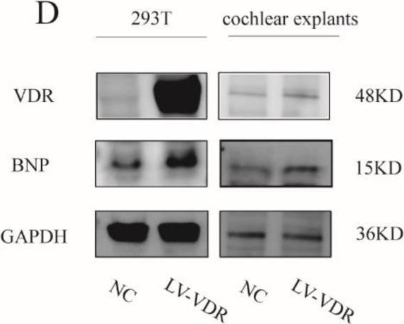 BNP antibodies - Antibody search engine - CiteAb