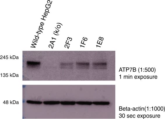 ATP7B antibodies - Antibody search engine - CiteAb