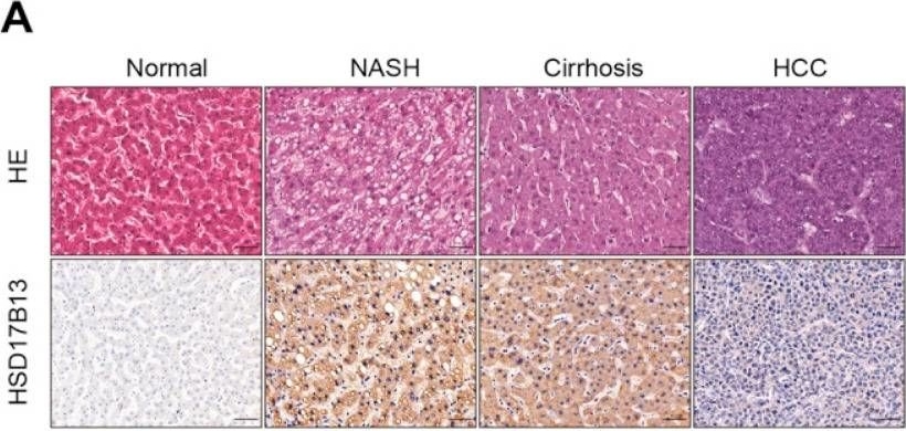 HSD17B13 antibodies - Antibody search engine - CiteAb