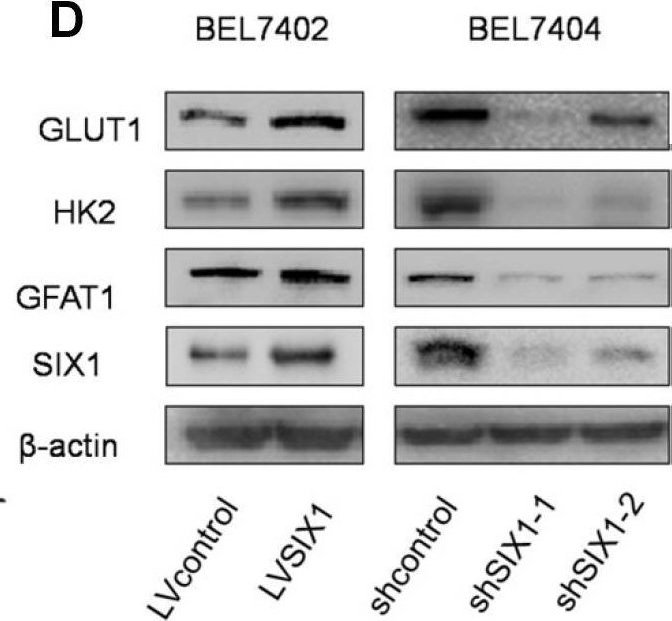 GFPT1 antibodies - Antibody search engine - CiteAb