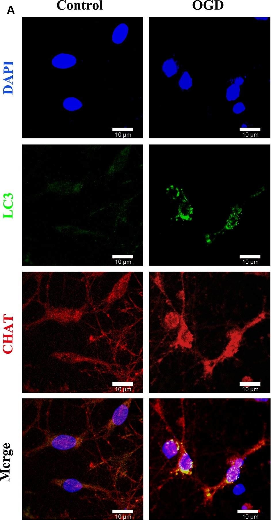 CHAT antibodies - Antibody search engine - CiteAb