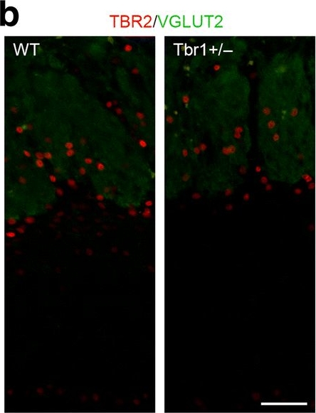 VGLUT2 antibodies - Antibody search engine - CiteAb