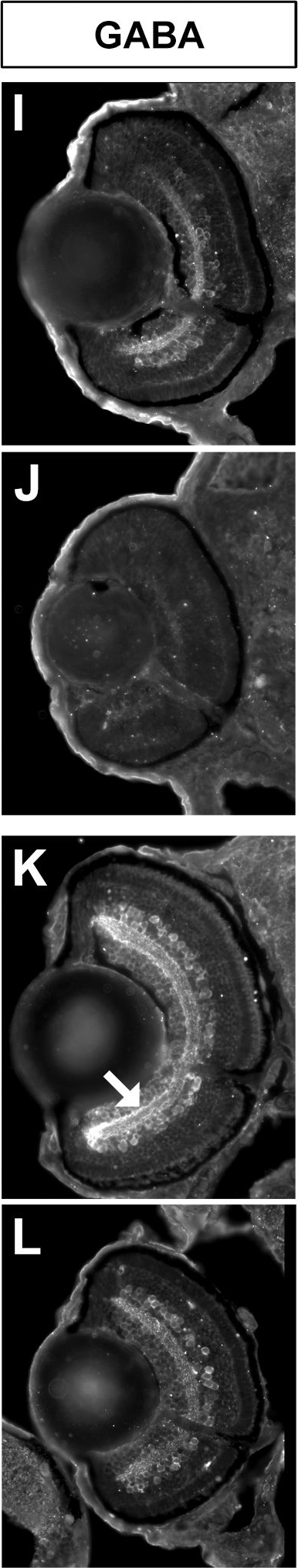GABA antibodies - Antibody search engine - CiteAb