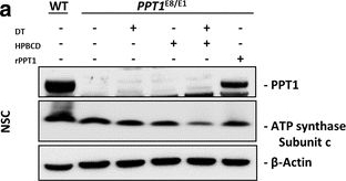 PPT1 antibodies - Antibody search engine - CiteAb