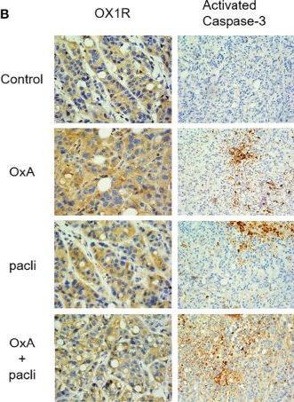 OXR1 antibodies - Antibody search engine - CiteAb