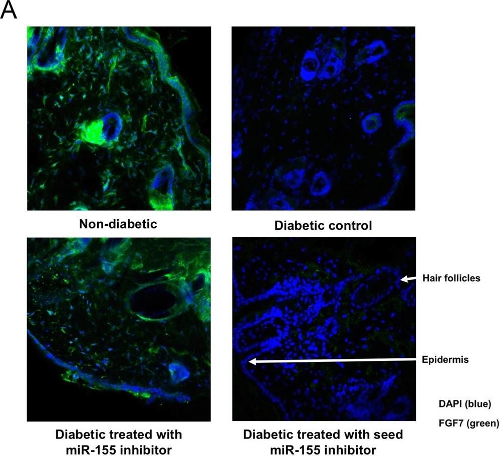 FGF7 antibodies - Antibody search engine - CiteAb