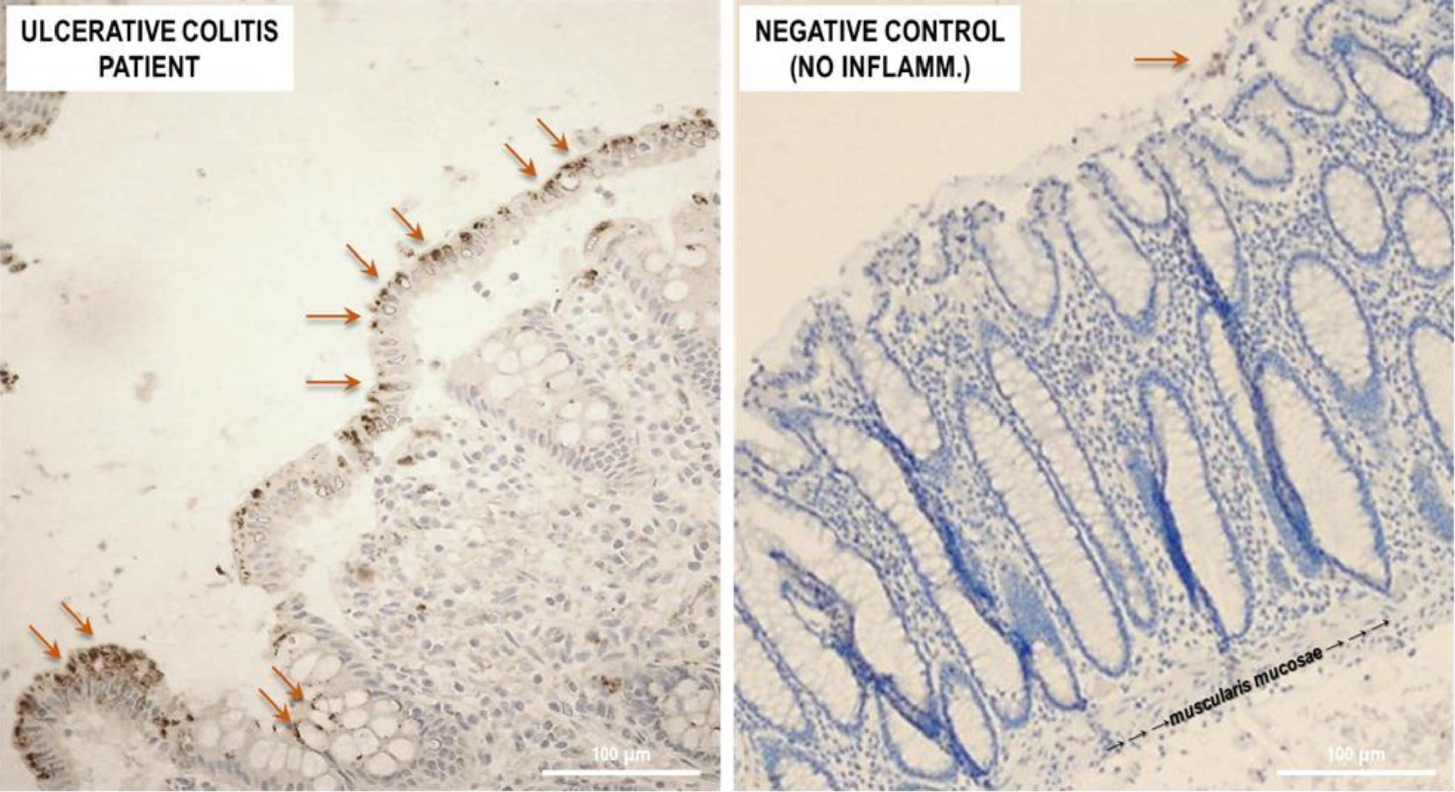 SLC15A4 antibodies - Antibody search engine - CiteAb
