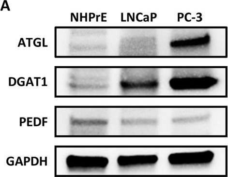 DGAT1 antibodies - Antibody search engine - CiteAb