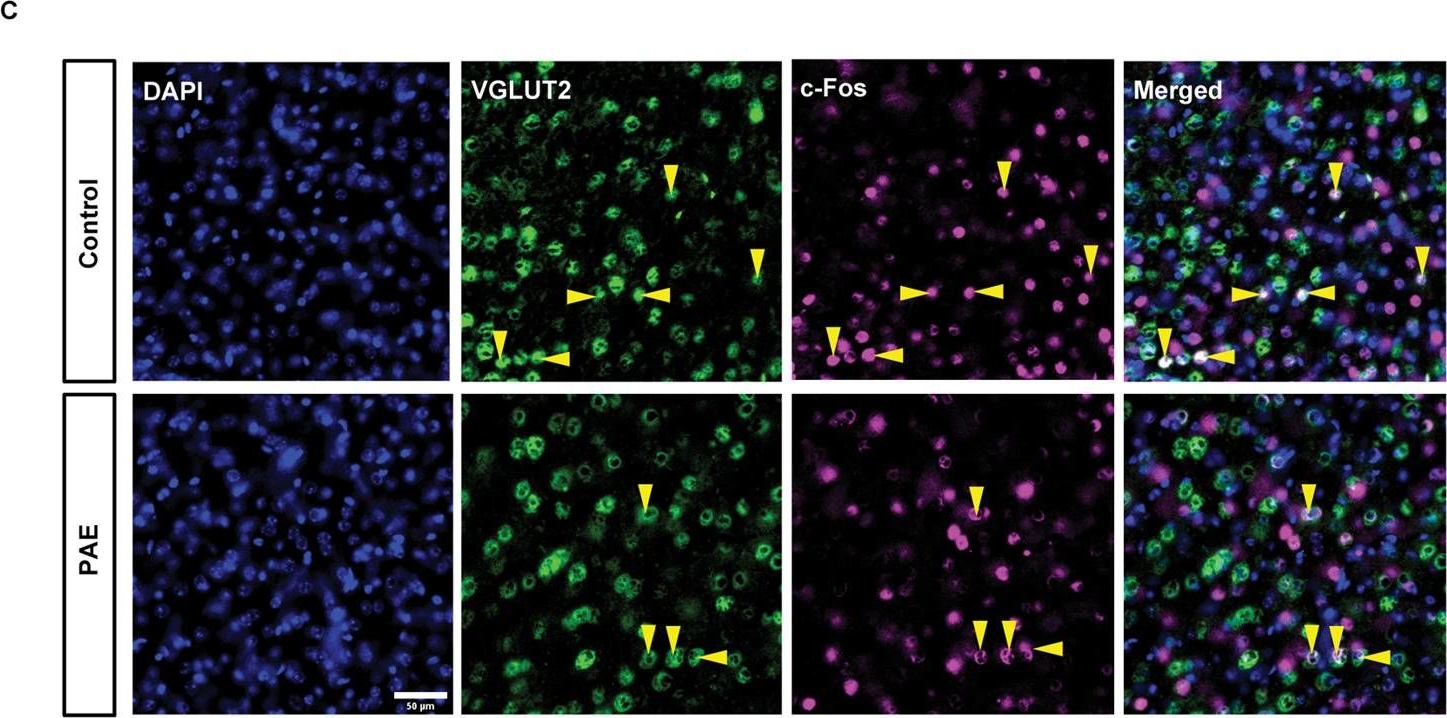 VGLUT2 antibodies - Antibody search engine - CiteAb