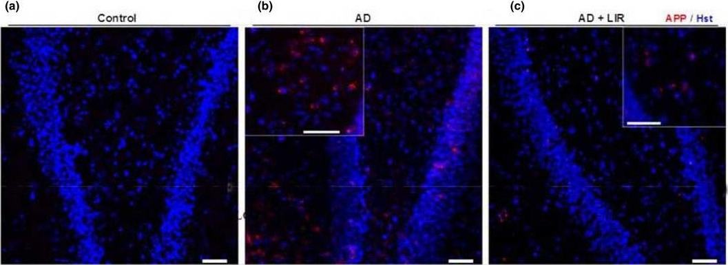 Abeta antibodies - Antibody search engine - CiteAb