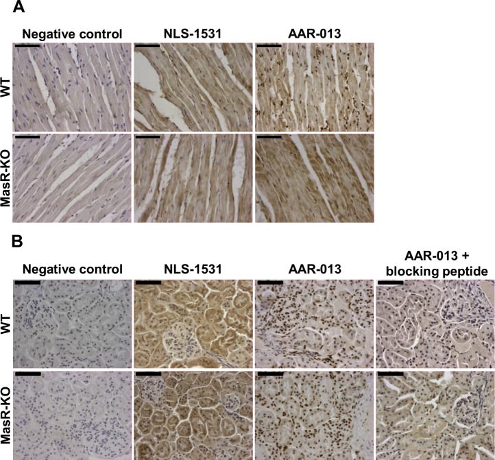 mas1 antibodies - Antibody search engine - CiteAb