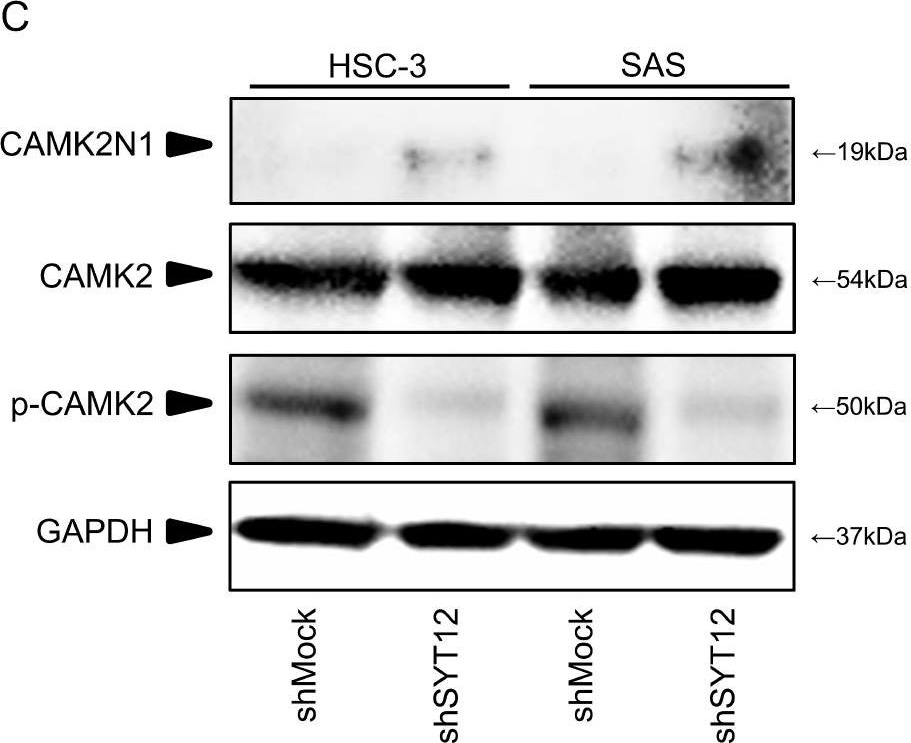 caMK antibodies - Antibody search engine - CiteAb