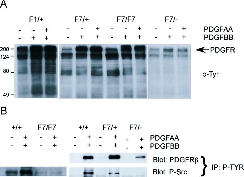 Pdgfrb antibodies - Antibody search engine - CiteAb