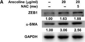 Zeb1 antibodies - Antibody search engine - CiteAb