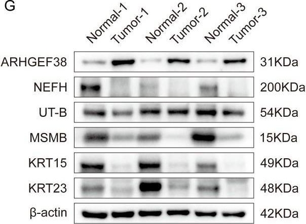 NF200 antibodies - Antibody search engine - CiteAb