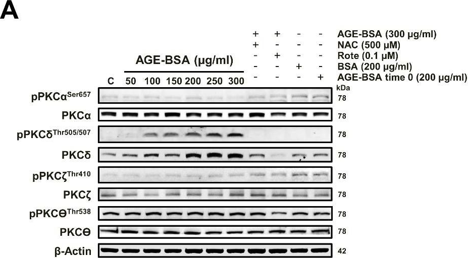 PRKACA antibodies - Antibody search engine - CiteAb