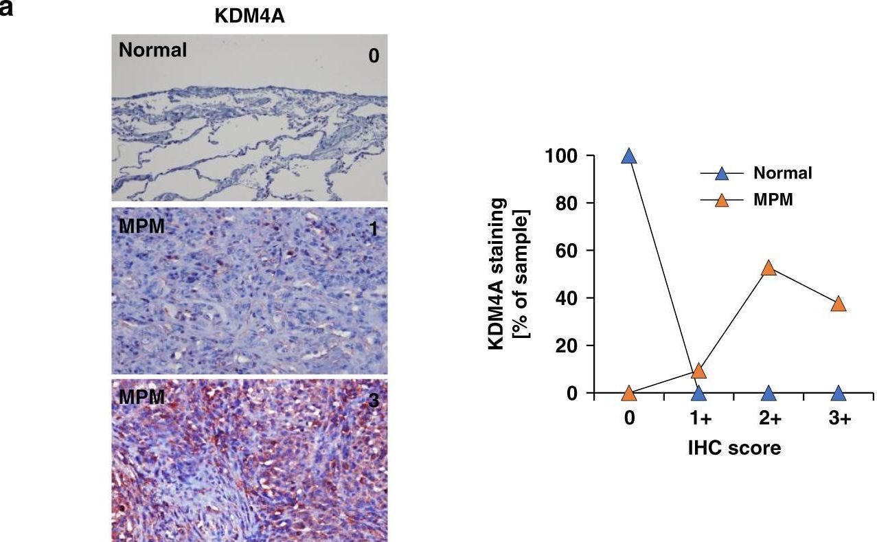KDM4A antibodies - Antibody search engine - CiteAb