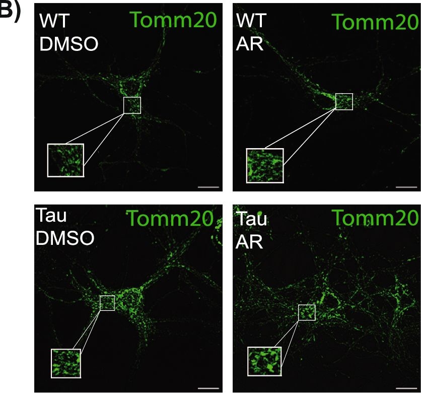 TOM20 antibodies - Antibody search engine - CiteAb