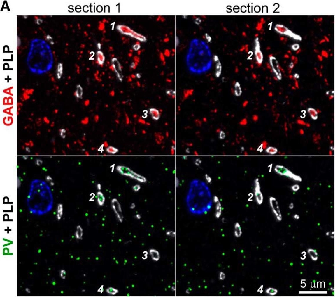 PLP1 antibodies - Antibody search engine - CiteAb