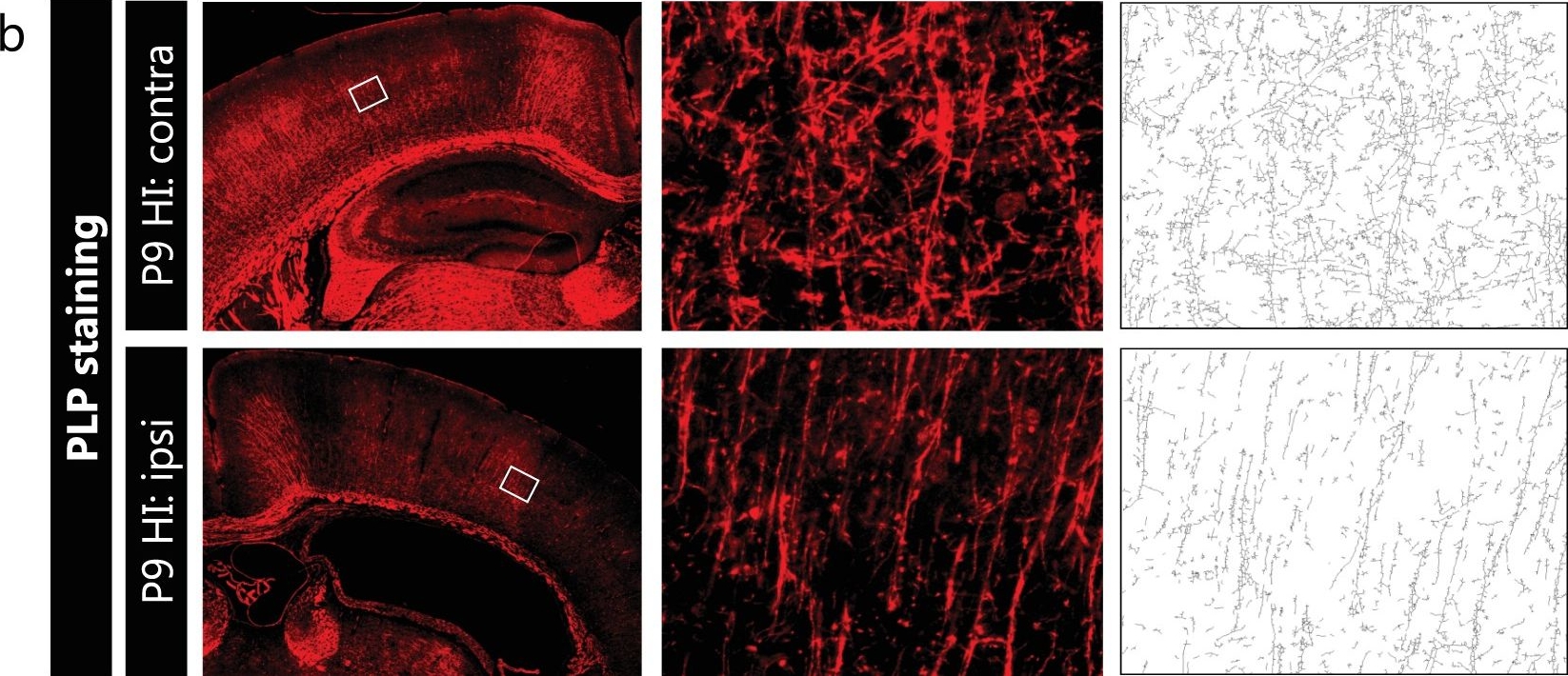 PLP1 antibodies - Antibody search engine - CiteAb