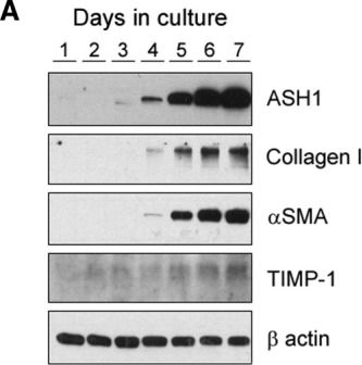 ash1l antibodies - Antibody search engine - CiteAb